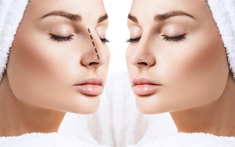 How To Make The Nose Look Slender? - Top Healthy Trials